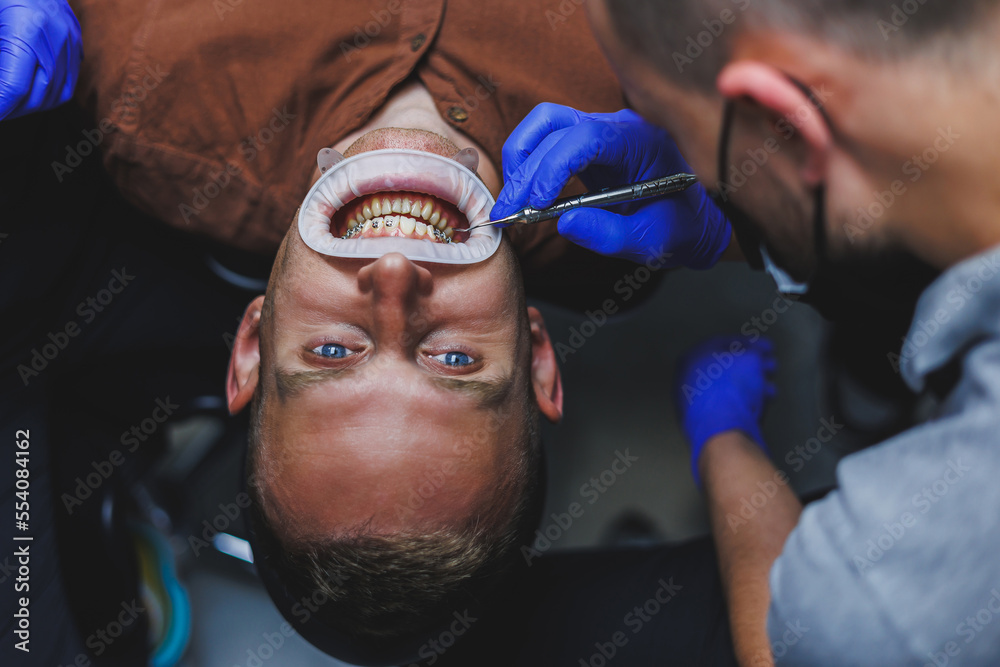 Dental treatment of teeth. A young man at a dentist's appointment. The ...