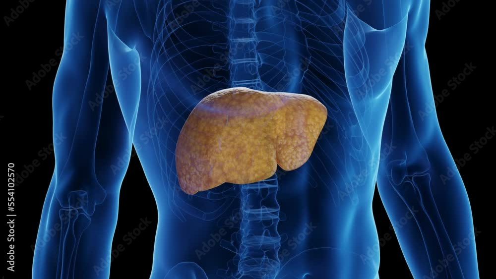 3D medical animation of a man's fatty liver vídeo de Stock | Adobe Stock