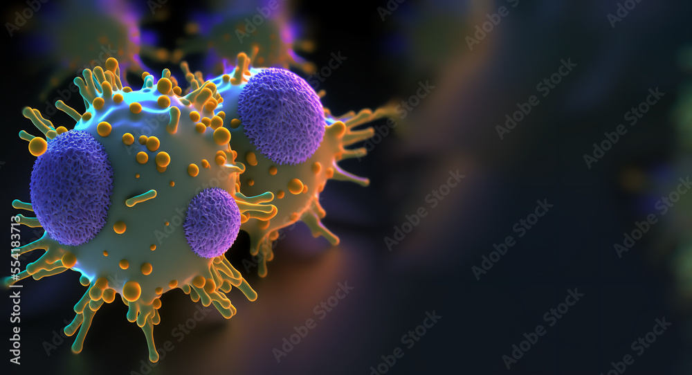 Chimeric antigen receptor CAR - car T-Cell therapy, CAR T-cell therapy ...