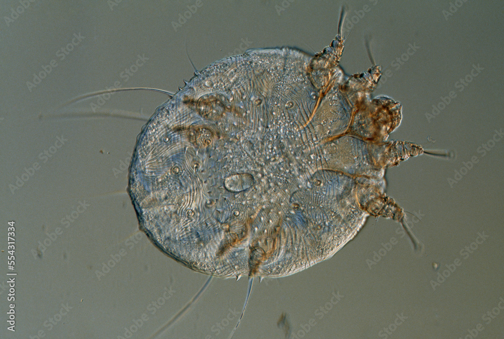 Microscopic view of a scabies mite (Sarcoptes scabiei), which causes a ...