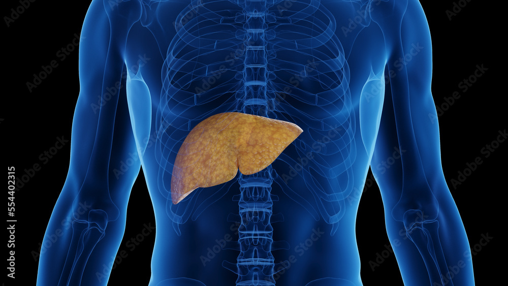 3D medical illustration of a man's fatty liver Stock Illustration ...