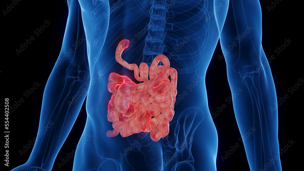 3D medical illustration of a man's inflamed small intestine Stock ...