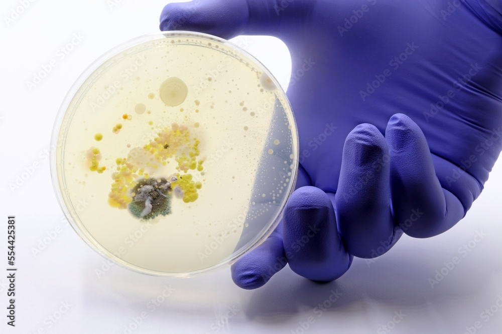 Doctor's or scientist's hand holding a microbiological culture Petri ...