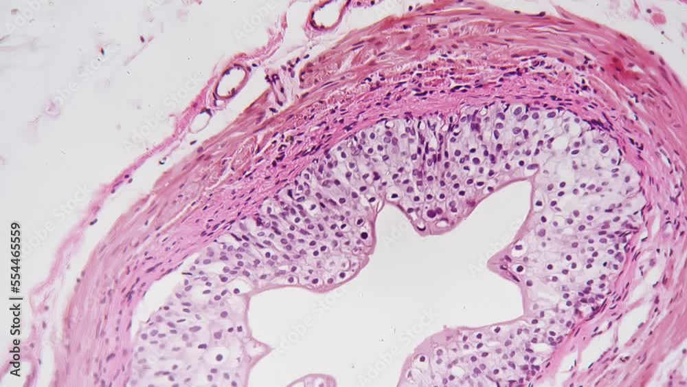 Human ureter in cross section filmed under light micrograph 200x on ...
