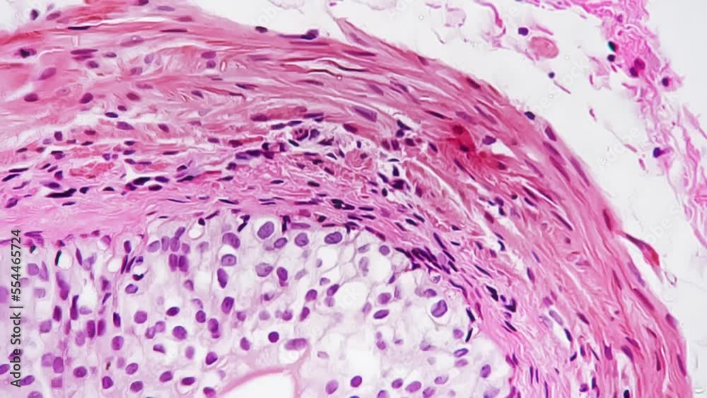 Cross section of human ureter filmed under the microscope 400x on ...