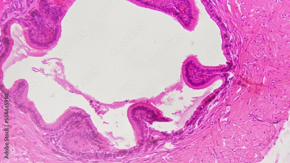 Human deferens in section magnified under microscope in 200 times ...