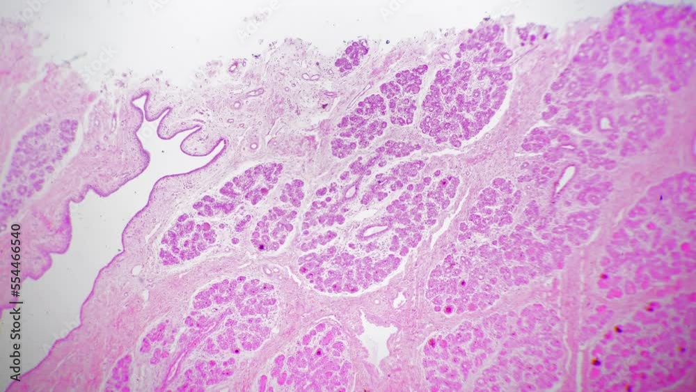 Stasis of mammary gland magnified in 100 times under microscope on ...