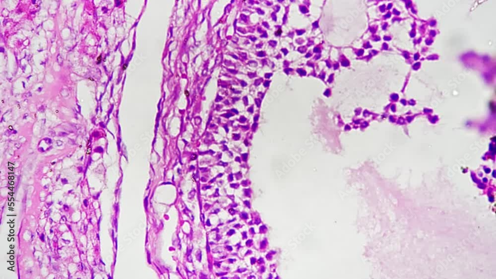 Section of the human ovary shown under microscope 400x on white ...