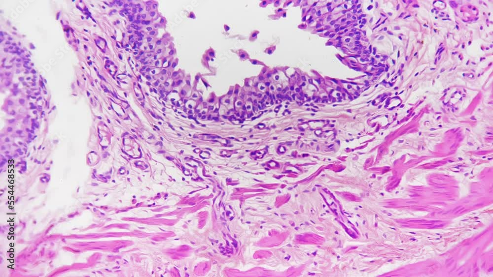 Urethra of human being in section filmed with 400x magnification under ...