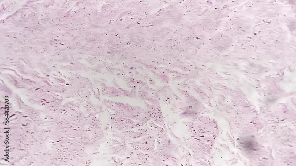 Section of human being fibro cartilage filmed on white background with ...