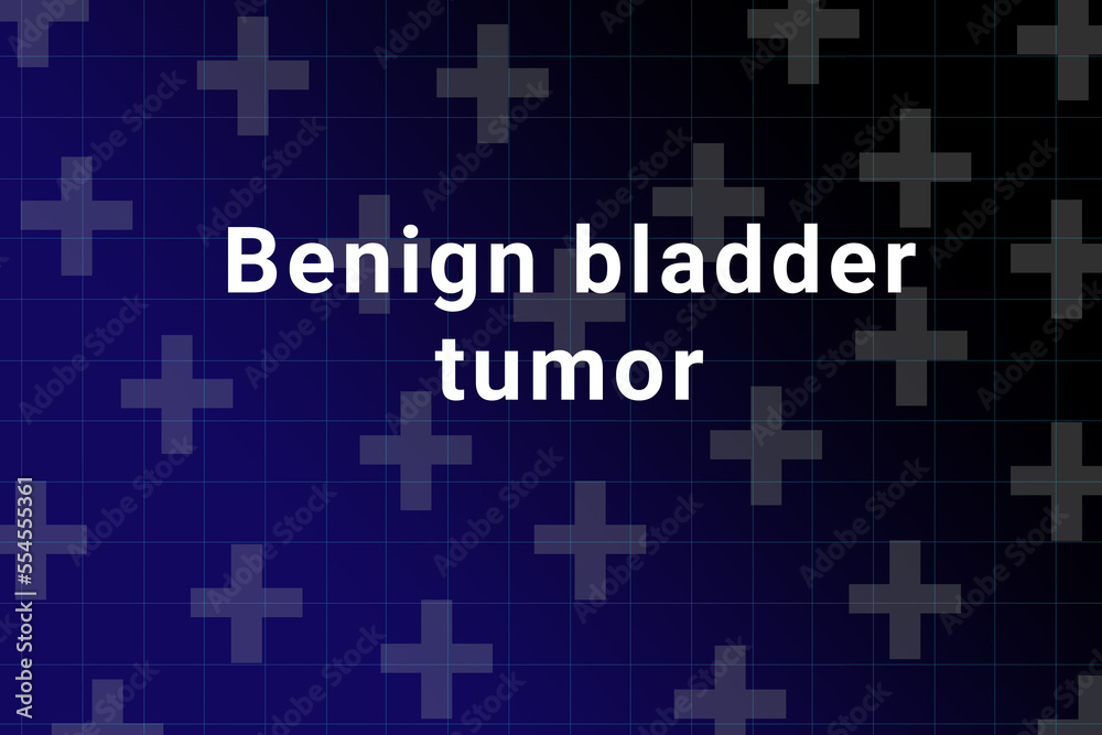 Benign bladder tumor disease Illustration. Benign bladder tumor title on medical background ...