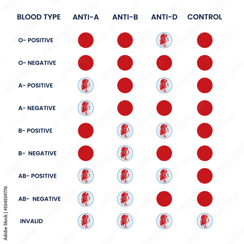 Biochemistry assay, enzyme immunoassay, laboratory test, chemical ...