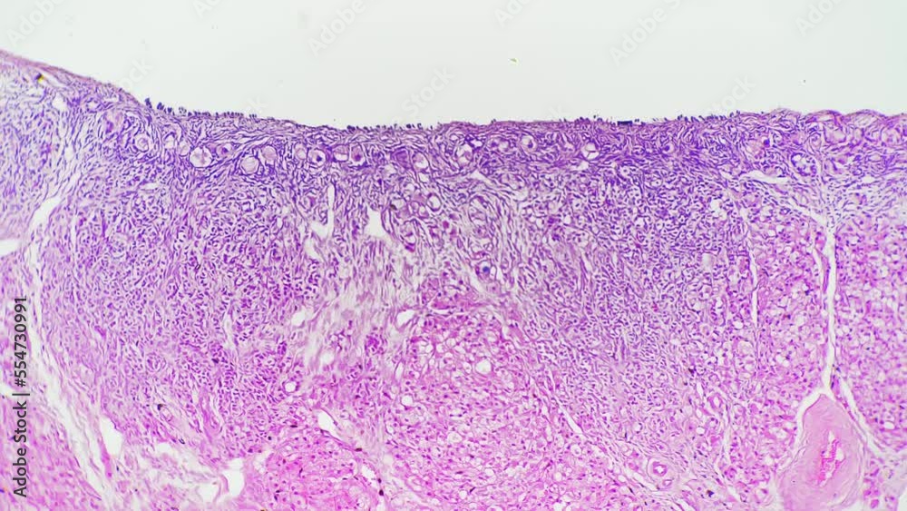 Section of the human ovary shown under microscope 200x against bright ...