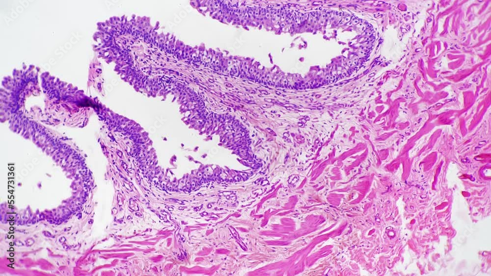 Section of human urethra filmed with 200 times magnification under ...