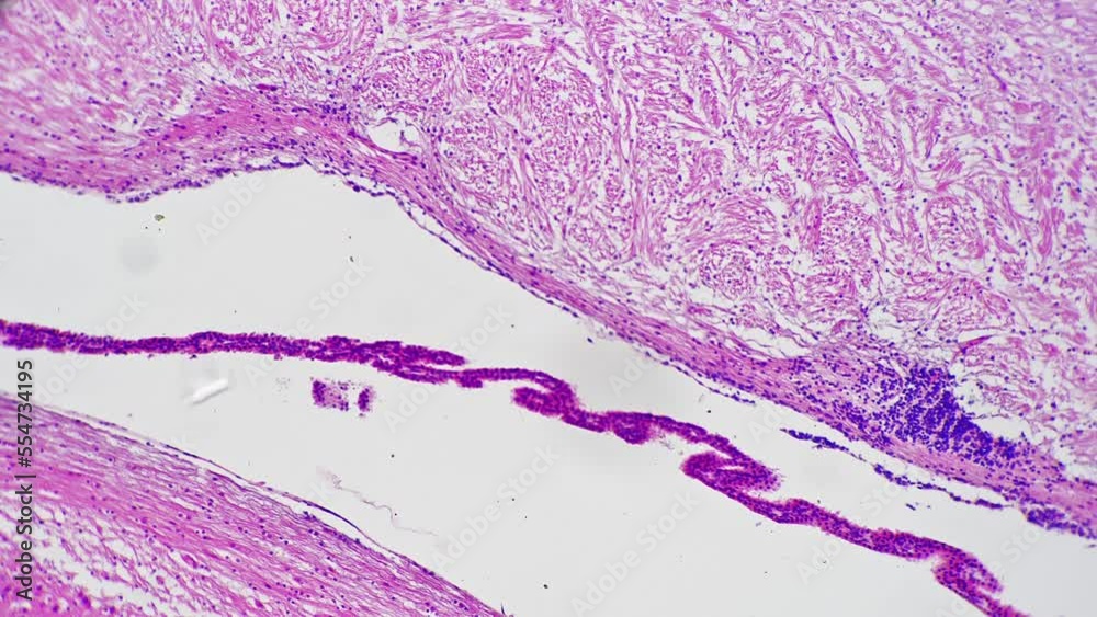 Human cerebrum in section with high magnification 100x shown under ...