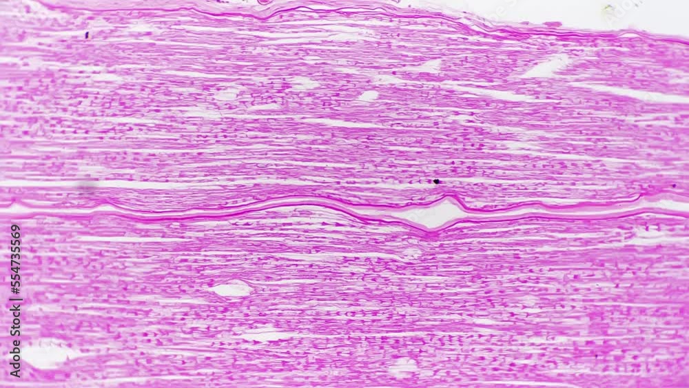 Longitudinal and transversal section of human nerves trunk magnified ...