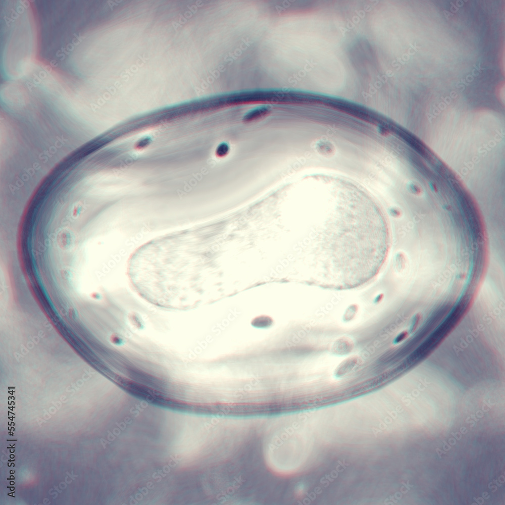 Abstract cell of virus or pathogenic bacterium under microscope ...