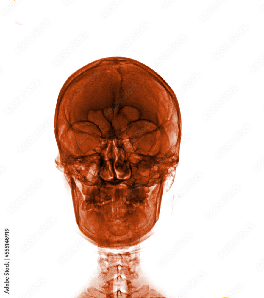 human skull anatomy Stock Photo | Adobe Stock