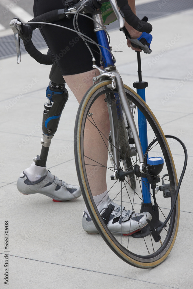 Woman with a prosthetic leg pumping air into a bicycle Stock Photo ...
