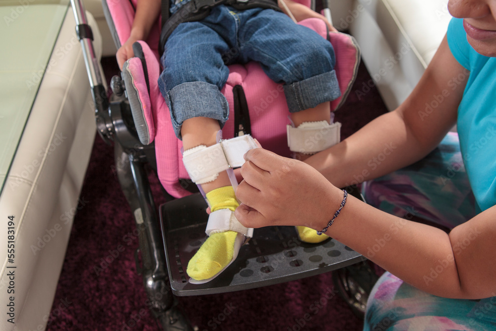 Mother putting leg brace on small daughter with Cerebral Palsy Stock ...