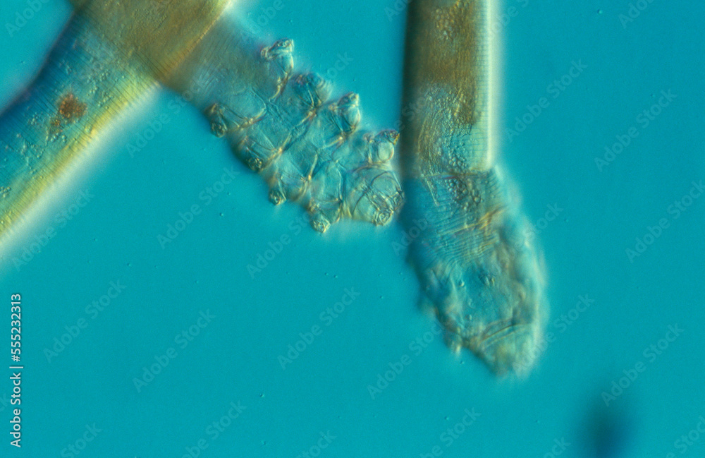 View of several mites (Demodex folliculorum), magnified 1000 times ...