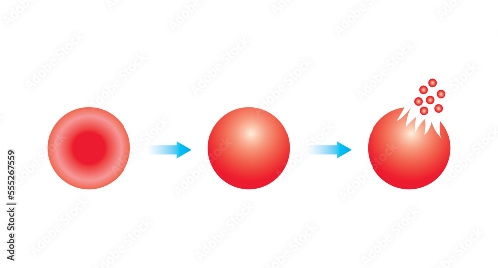Scientific Designing of Hemolysis. The Destruction of Red Blood Cells ...