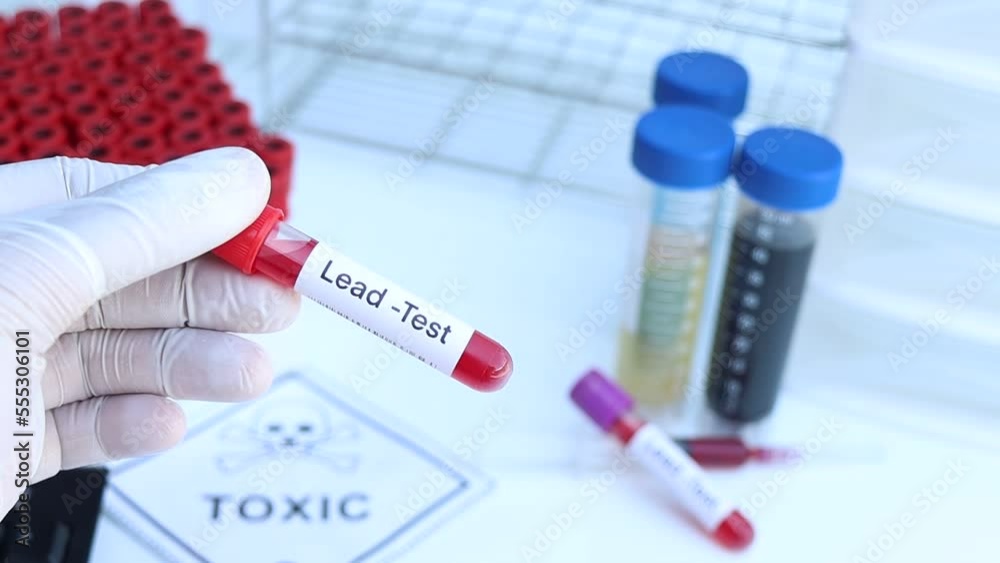 Lead test to look for abnormalities from blood, blood sample to analyze ...