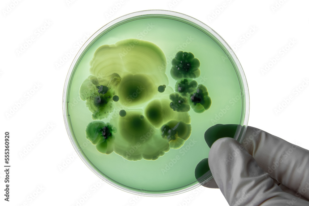 Hand with Petri dish or culture media with bacteria on white background ...