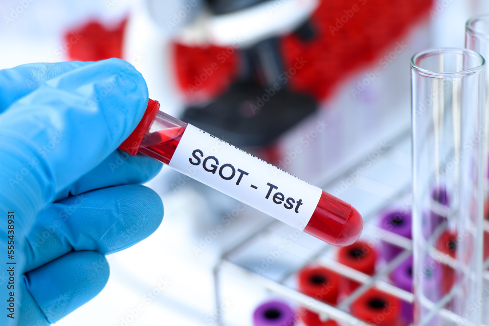 SGOT test to look for abnormalities from blood Stock Photo | Adobe Stock
