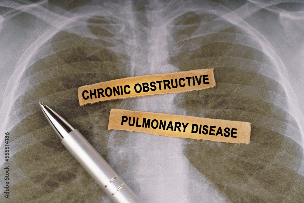 Poster On a human chest x-ray, a pen and strips of paper labeled ...