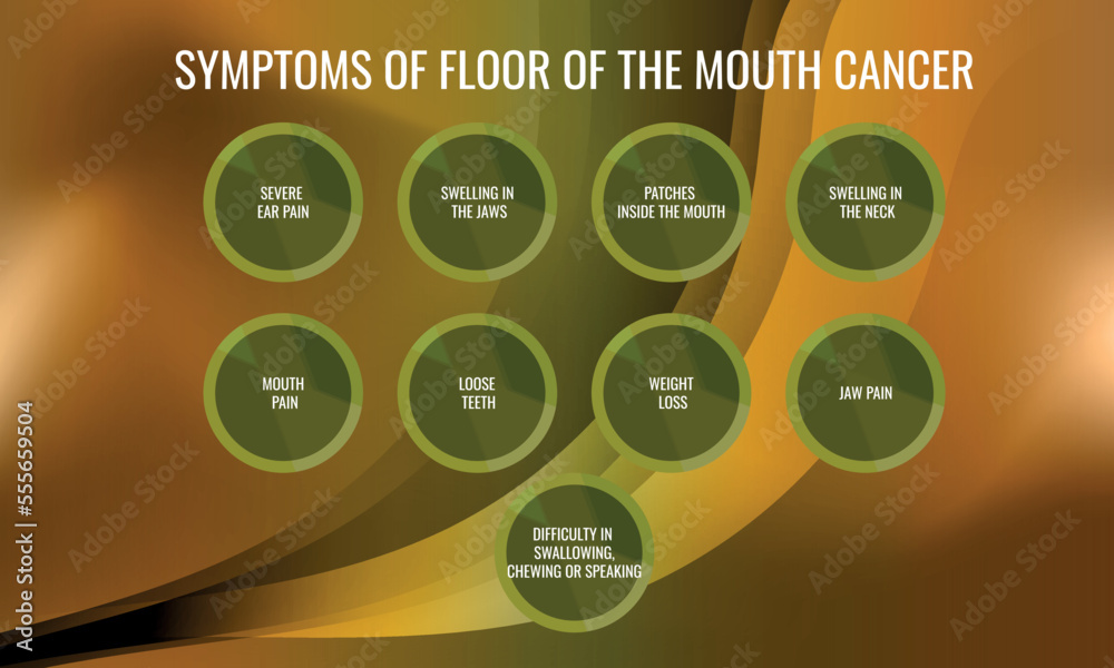 SYMPTOMS OF Floor of the mouth cancer. Vector illustration for medical ...