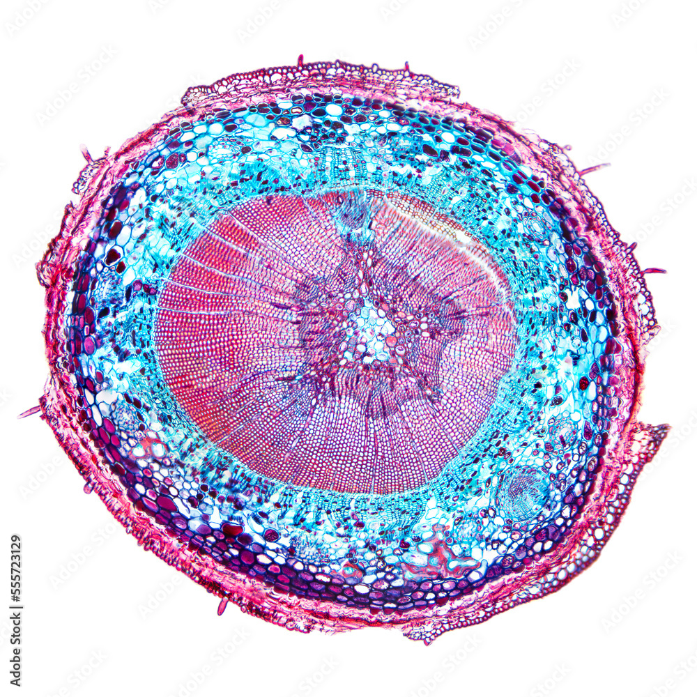 Pine tree stem, cross section, 20X light micrograph. Conifer tree in ...