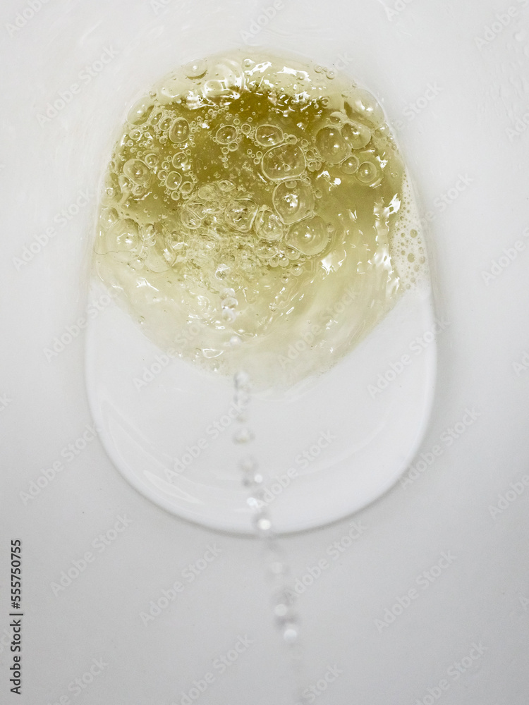 The lavatory in the toilet and the stream of urine during urination ...
