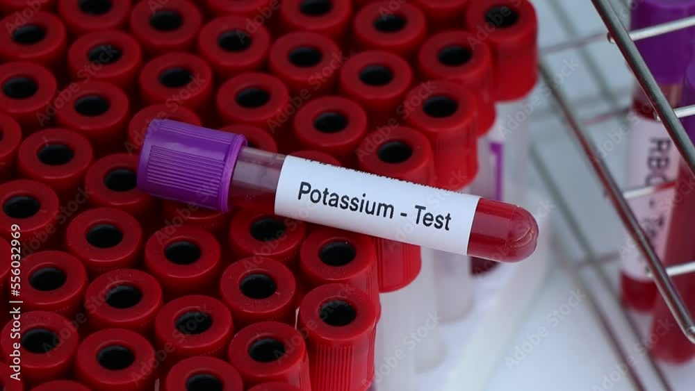Potassium test to look for abnormalities from blood, blood sample to ...