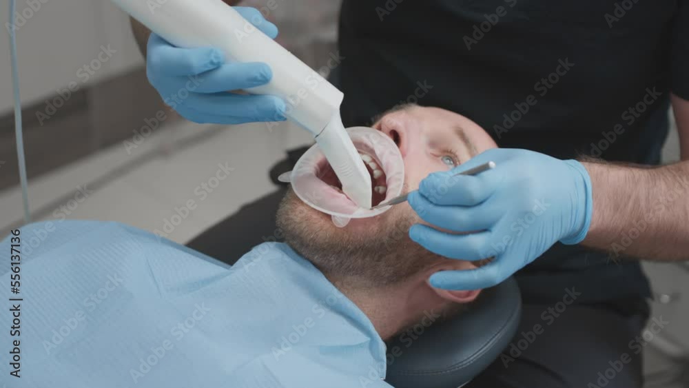 Vidéo Stock Orthodontist using 3D intraoral scanner for scanning teeth ...