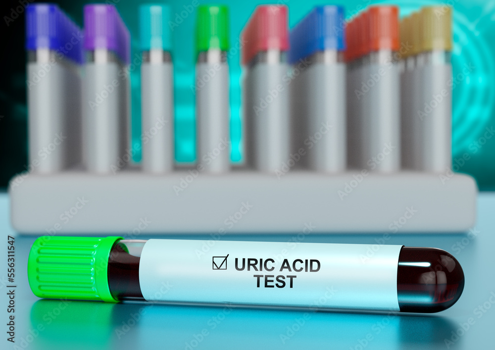 Human blood sample in the tube for testing uric acid levels Stock Photo ...