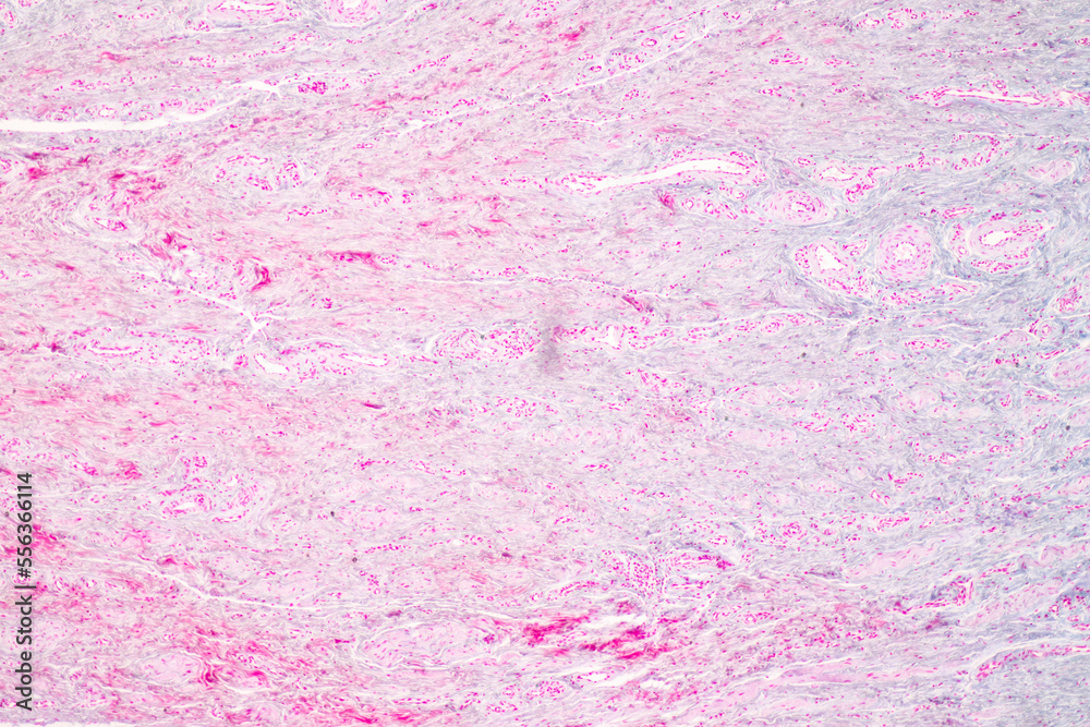 Backgrounds of Characteristics Tissue of Vagina Human under the ...