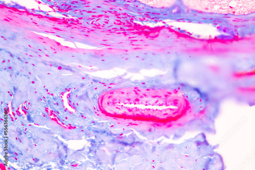 Characteristics Tissue of Optic nerve Human, Cornea from eye Human and ...