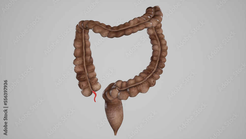 Anatomical Illustration of Large Intestine Appendix.3d rendering Stock ...