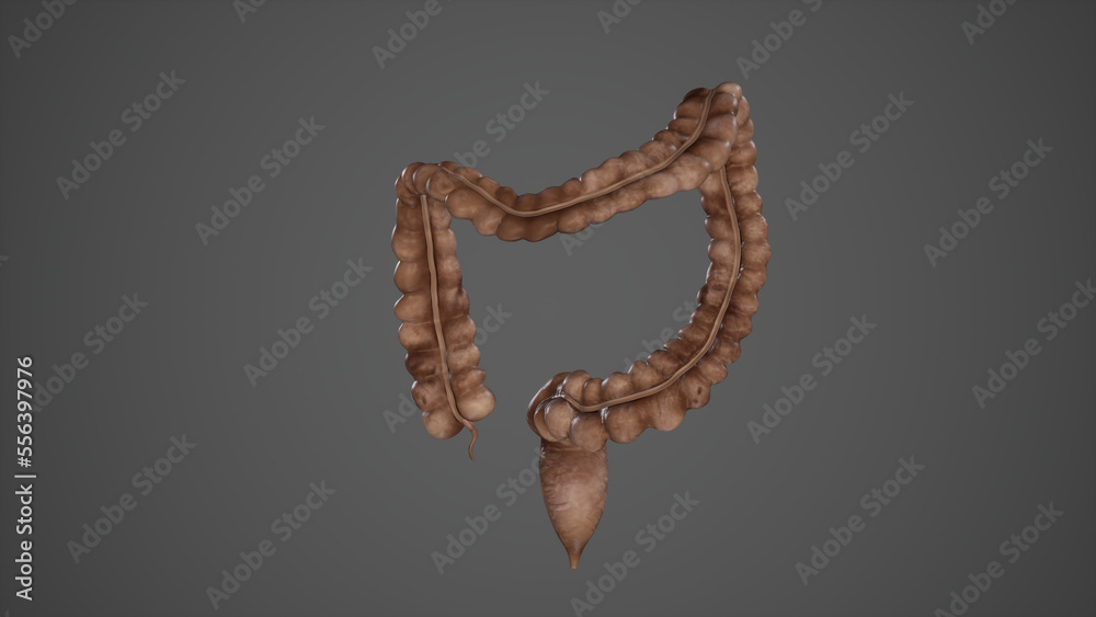 Anatomical Illustration of Large Intestine.3d rendering Stock ...