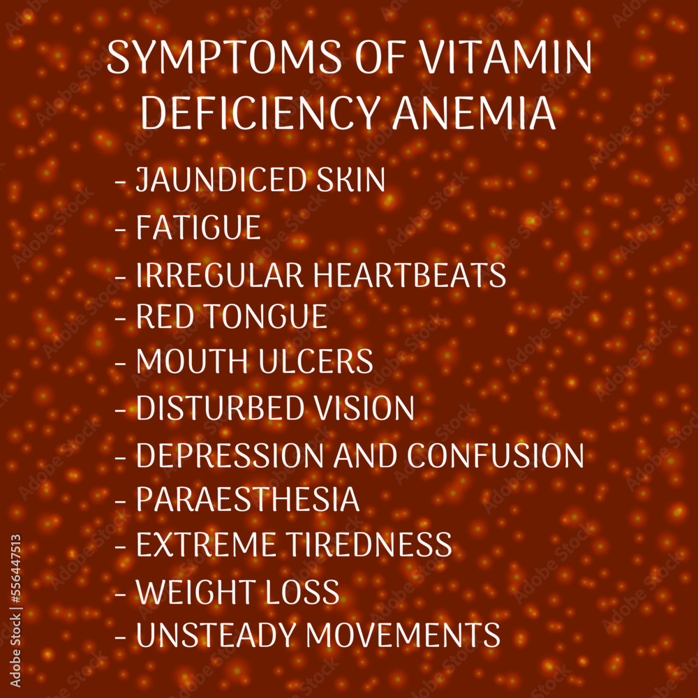 Vecteur Stock symptoms of Vitamin deficiency anemia. Vector ...