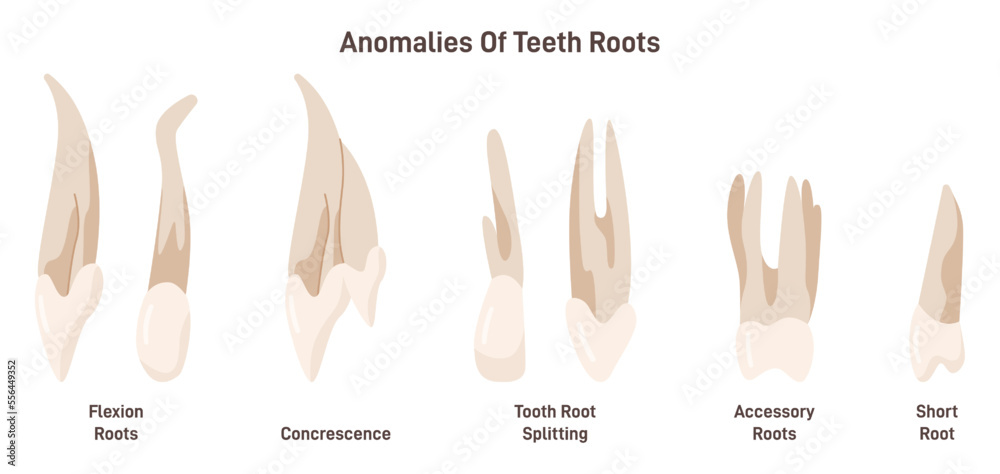 Anomalies of teeth roots. Adult human teeth, molar premolar canine ...