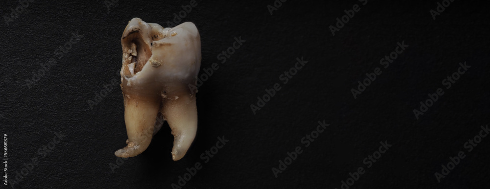 Teeth Texture