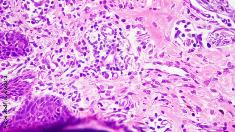 Scientific macro slide of human lip in section 400x made for ...