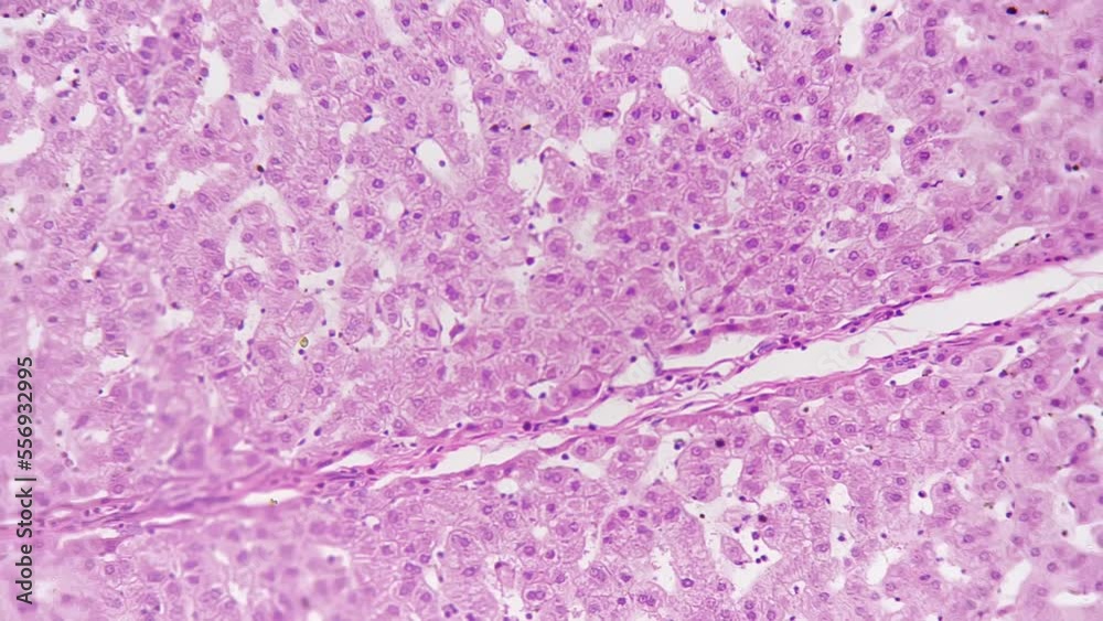 High magnification 200x of human liver shown under light micrograph ...