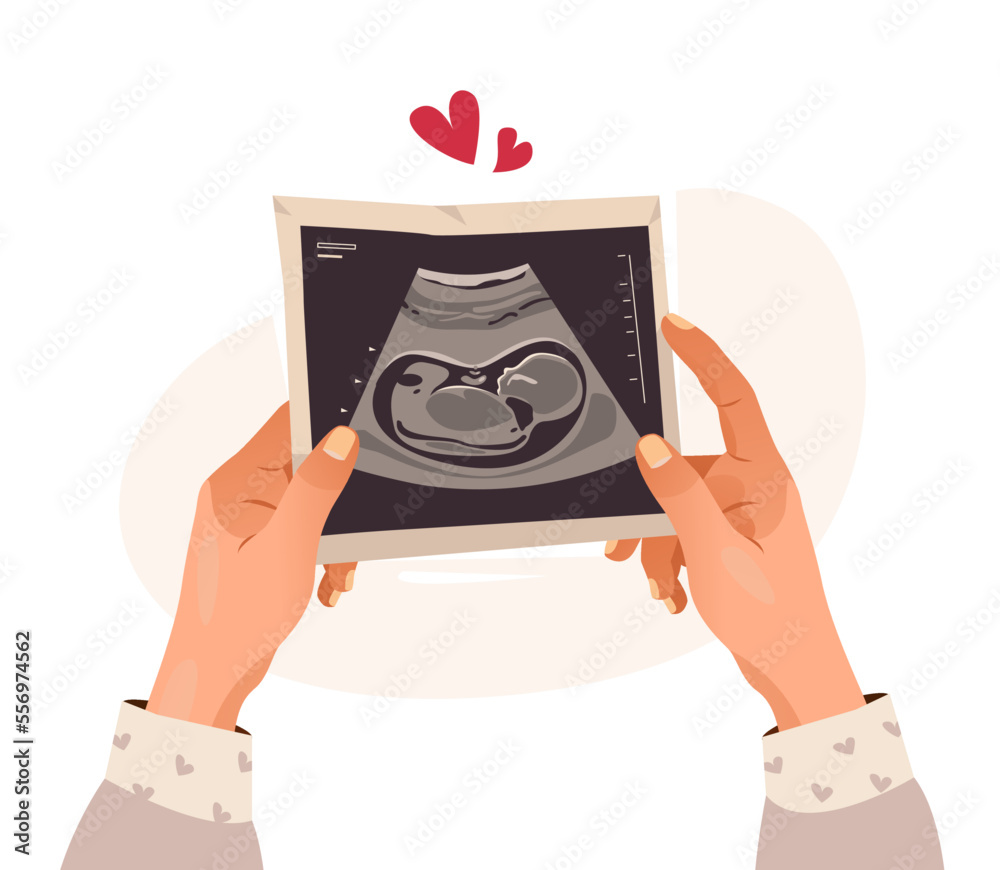 Hands holding a photo of a baby on ultrasound scan in the womb ...
