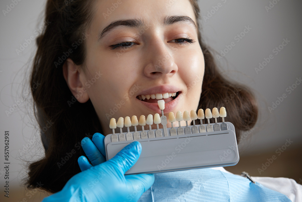 Dentist choosing color of tooth enamel for patient. Dentist applying ...