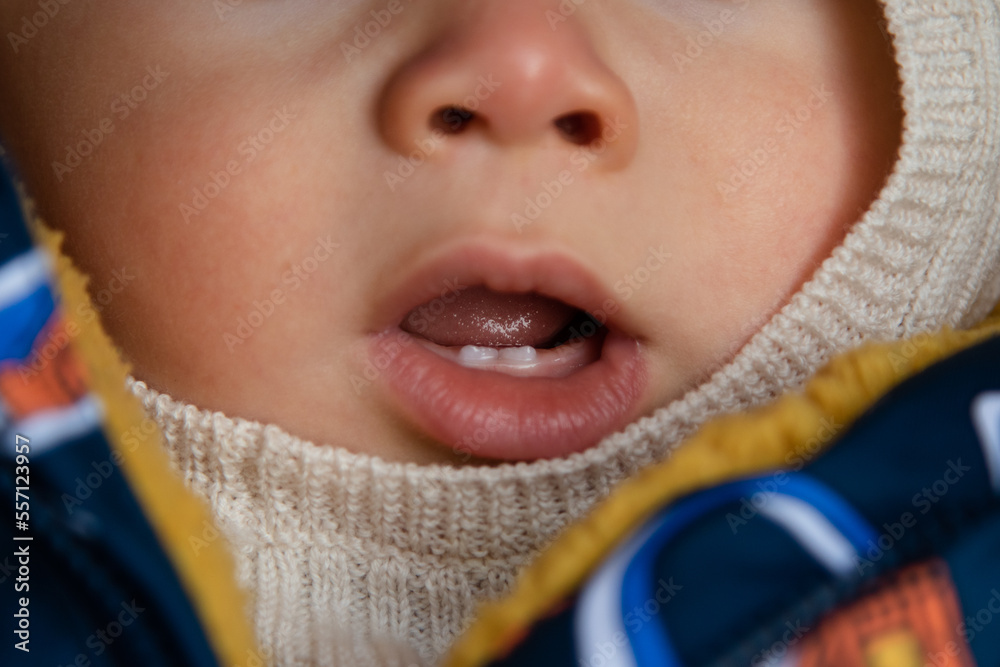 The first two milk teeth in a child, the front incisors Stock Photo ...