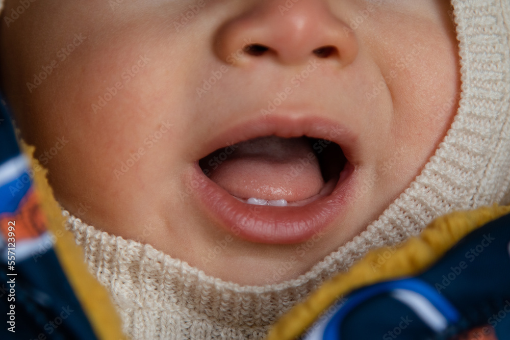 The first two milk teeth in a child, the front incisors Stock Photo ...