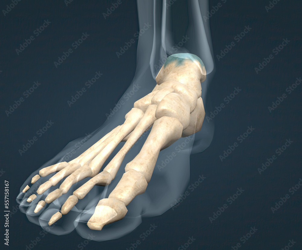 The foot is conventionally divided into three zones. hindfoot, midfoot ...